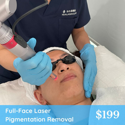 Full Face Laser Pigmentation Removal Special | AQUA LASER CLINIC