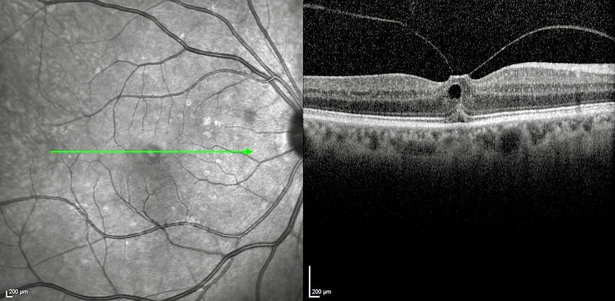 Retinal Diagnostic Testing | Retina Treatment Center