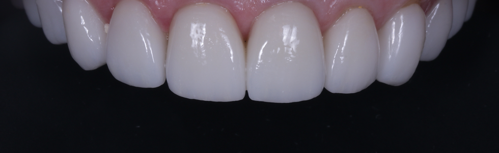 Fitzgerald Dental Studio Case Photos | Quality Dental Products