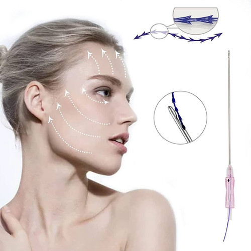 PDO Fishbone Thread | Abi Cole Aesthetics