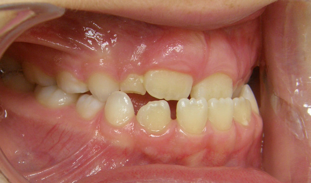 Is it too early to take my child to an orthodontist?