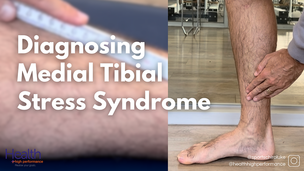 Diagnosing medial tibial stress syndrome