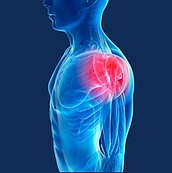 Brett Robin, MD | top orthopedic surgeon central texas