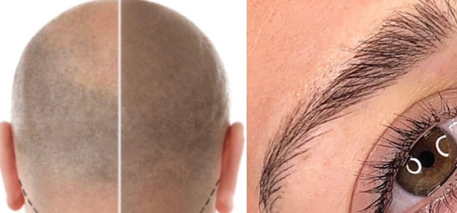 Cosmetic Eyebrow Micropigmentation Owen Sound I Janet Faith