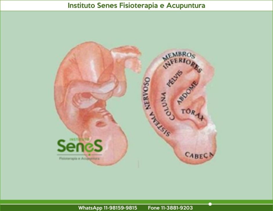 A orelha é um fascinante microssistema que reflete todo o corpo humano