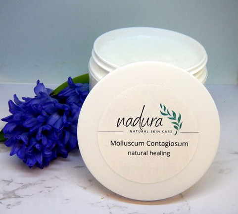 Natural Healing Molluscum Contagiosum Salve (Water Warts) | Nadura Skin ...