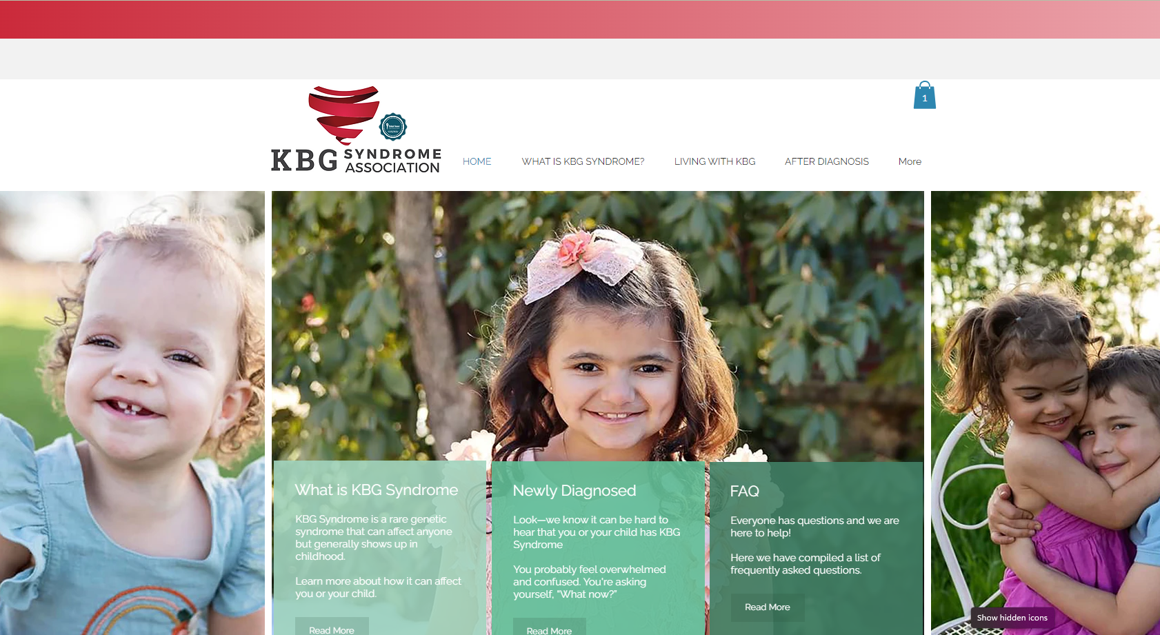 HOME | KBG Syndrome