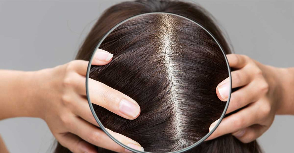 Achieving a Healthy Scalp: Expert Tips and Treatments in Singapore