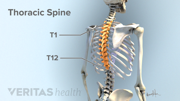 Treat shoulder and neck pain with thoracic spine mobility