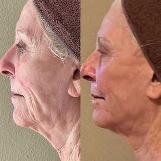 JET PLASMA | COOL PLASMA