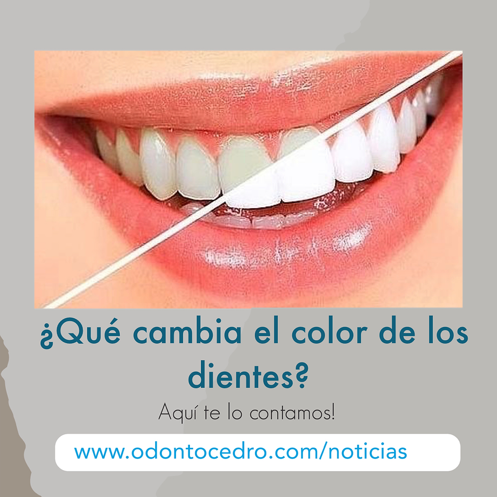 ¿Qué cambia el color de los dientes?