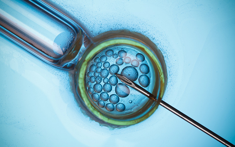 Microsurgical Testicular Sperm Extraction (microTESE) | Dr. Vasilas ...