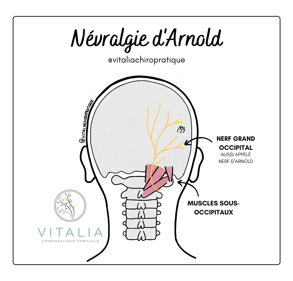 Soulager la névralgie d'Arnold