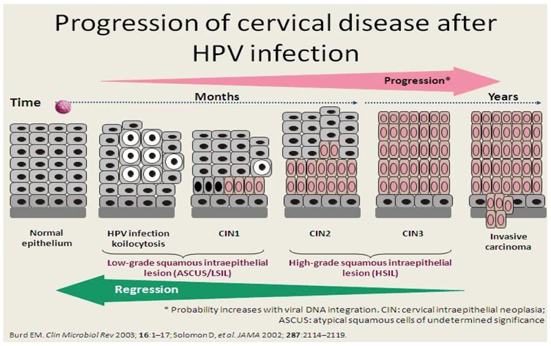 HPV (Virus Papiloma Humano)