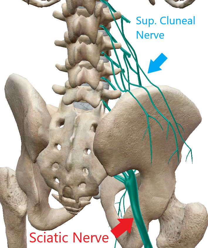Pain in the Butt?? It Could be "Pseudo-Sciatica!"