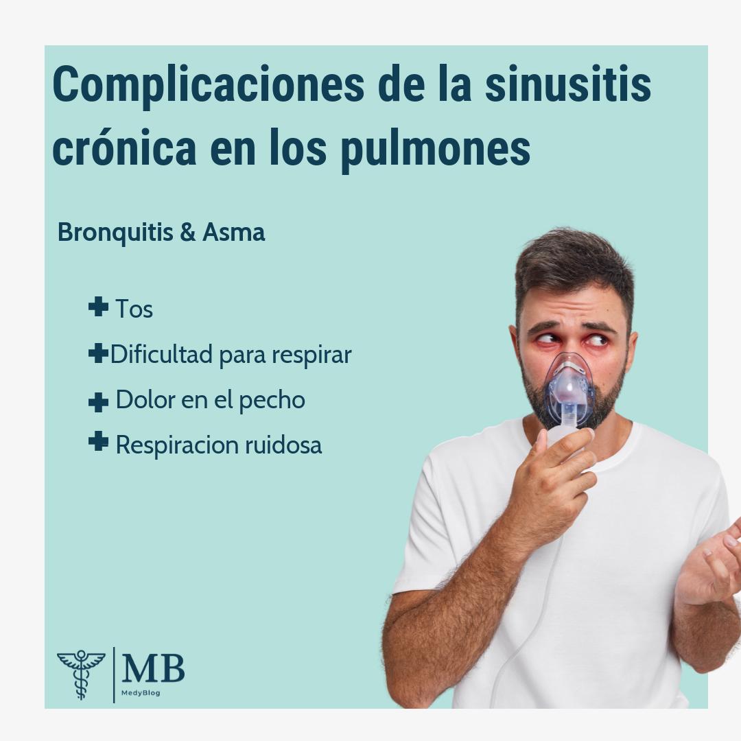 Complicaciones de la Sinusitis