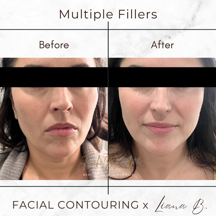 Touch Me Up Medical Spa | Beauty Treatments | La Crescenta | Burbank