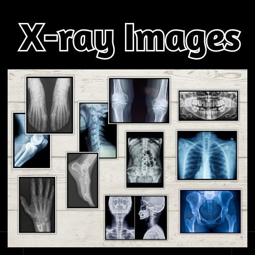 X-ray Classroom Display Images | PrimaryResourceRack