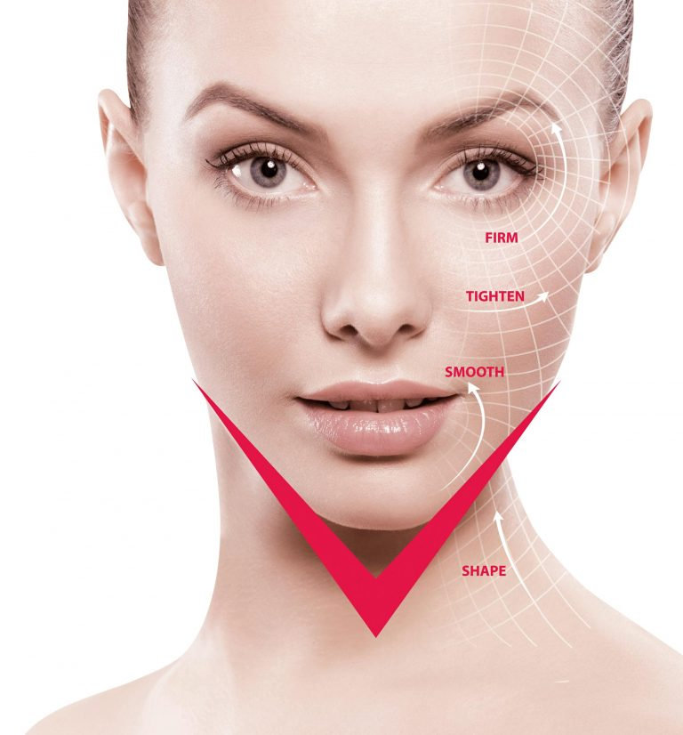 What is V lifting Facial?