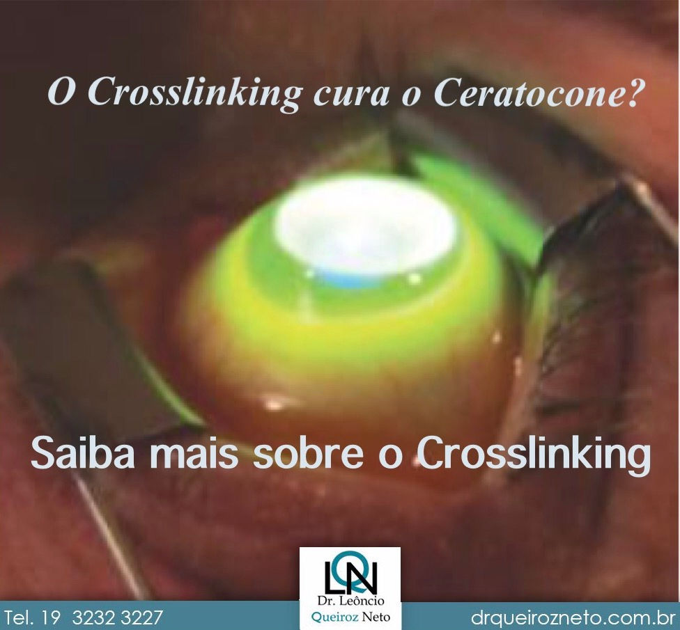 Saiba mais sobre o Crosslinking da córnea