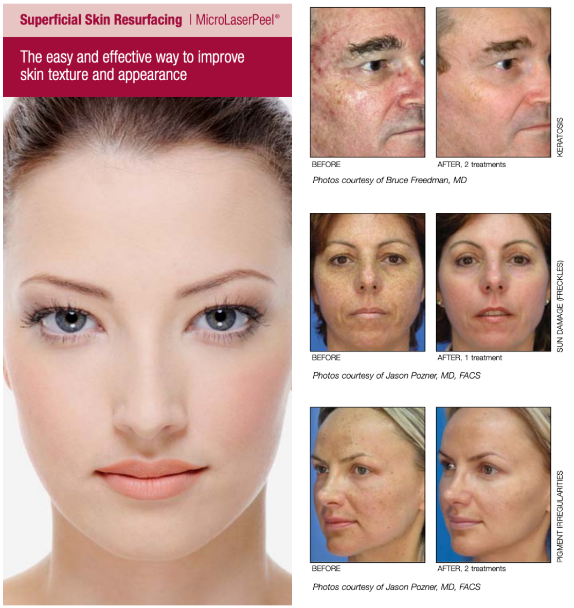 MICRO | Skin Wellness MD