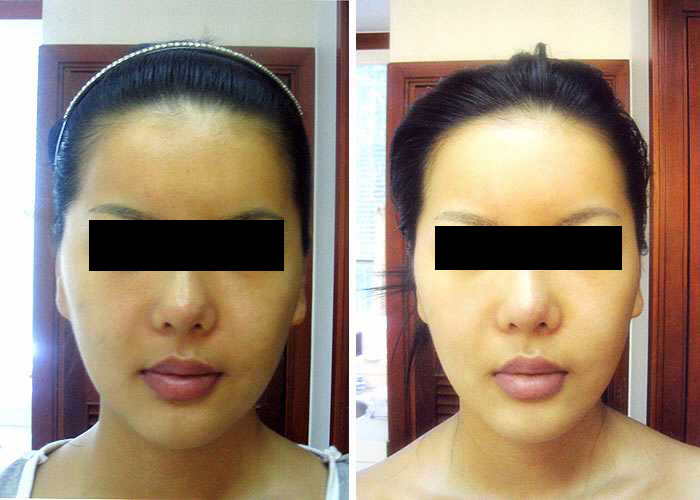 GALLERY | sjskintherapy