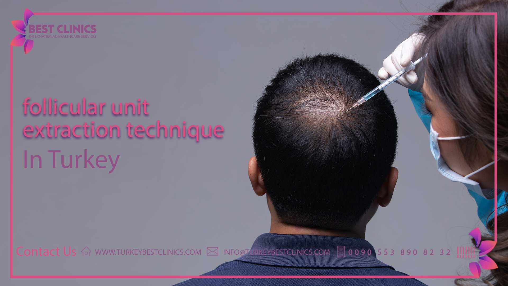 FUE Hair Transplantation in Turkey - The Guide to FUE Hair ...