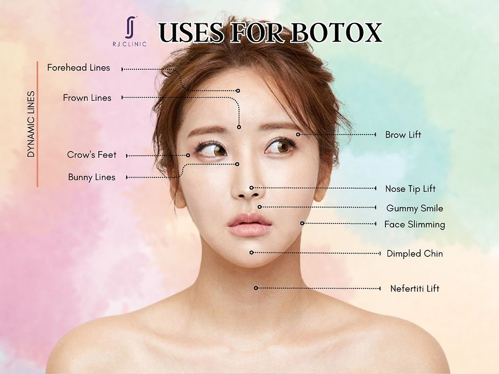 Botox: The Versatile Solution at RJ Clinic in Kuala Lumpur