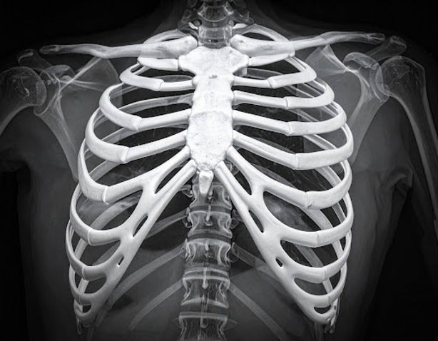 Rib Subluxation Symptoms and Treatment | Chest Pain Explained