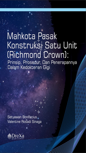 Mahkota Pasak Konstruksi Satu Unit (Richmond Crown): Prinsip, Prosedur ...