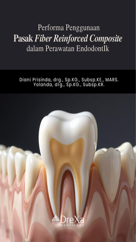 Performa Penggunaan Pasak Fiber Reinforced Composite Dalam Perawatan Endodontik | Drexa Publisher