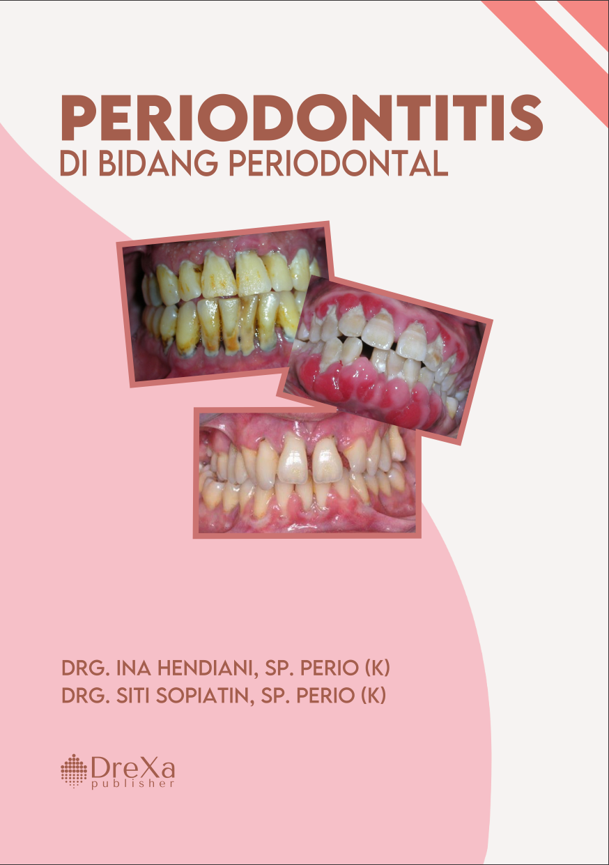 PERIODONTITIS DI BIDANG PERIODONTAL | Drexa Publisher
