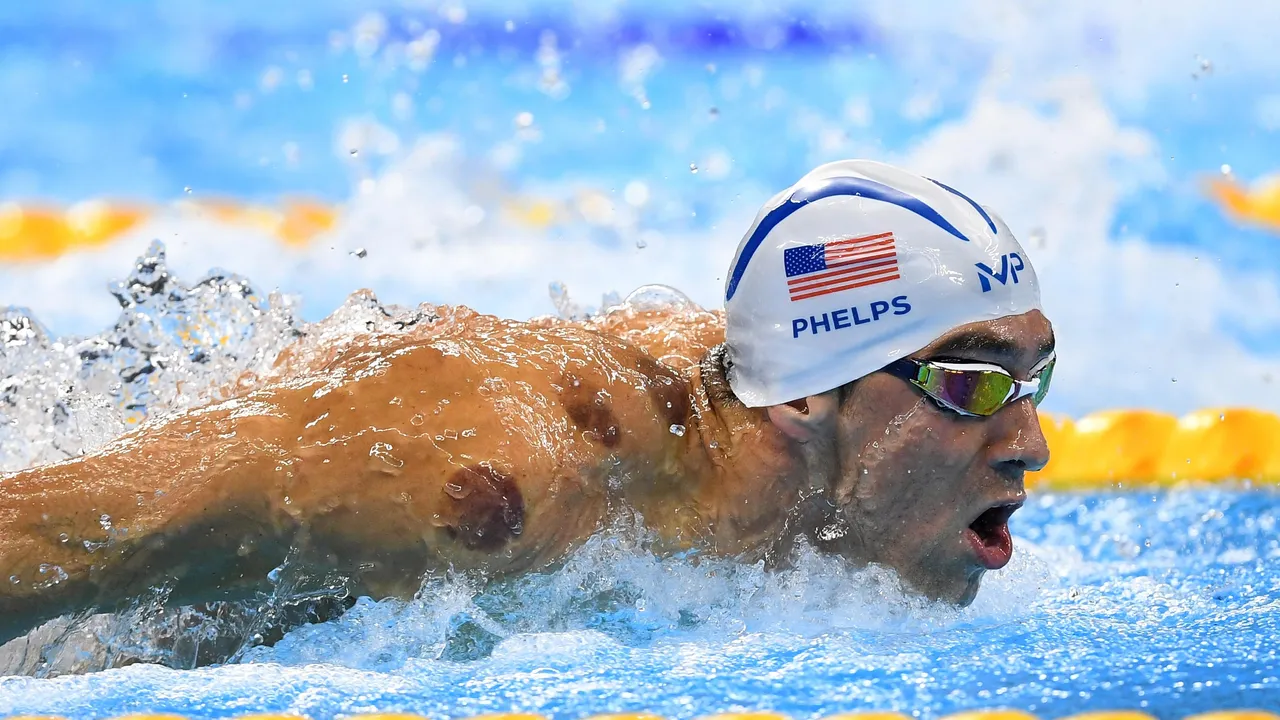 Cupping at State 11 Soft Tissue Therapy | Spalding's 5 * clinic