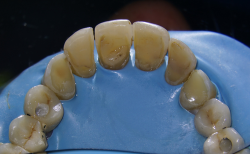 RUBBER DAM – Friday 26 June 2026 | ACE Courses