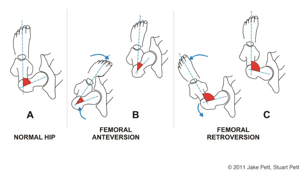 5 Factors that Affect Turnout