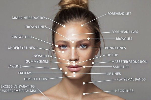 Botox | SophiaEsthetic