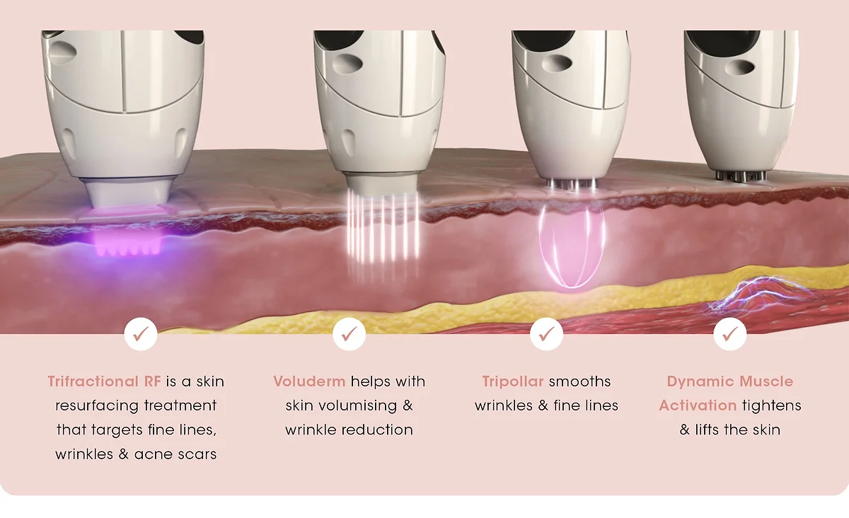 Divine Pyramid Facelift | SophiaEsthetic