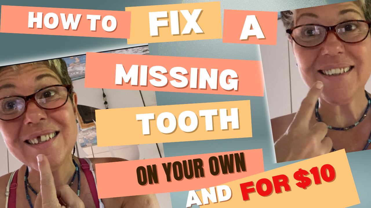 How To Fix A Missing Tooth On Your Own