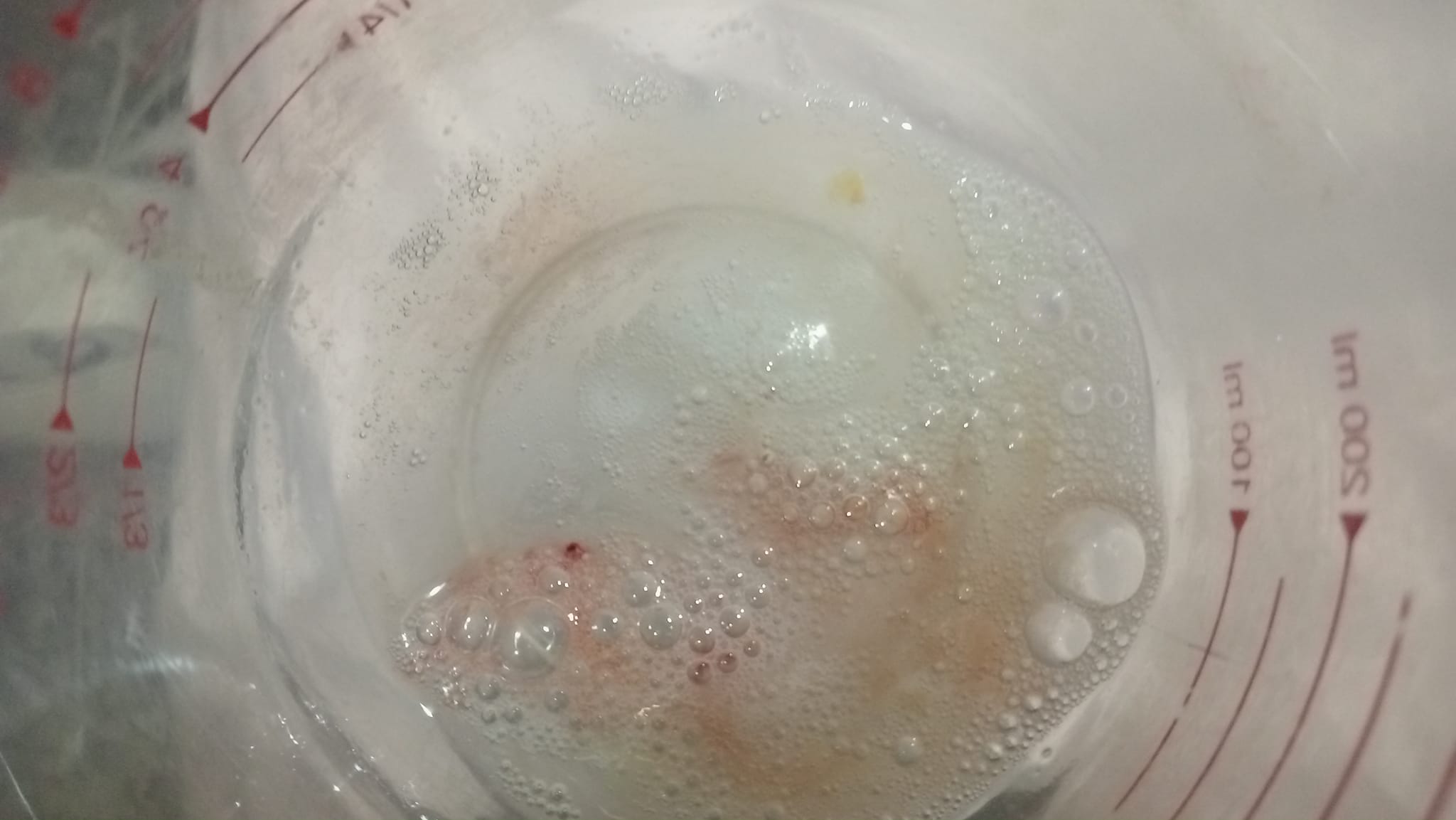 Whooping cough or Bleeding cough
