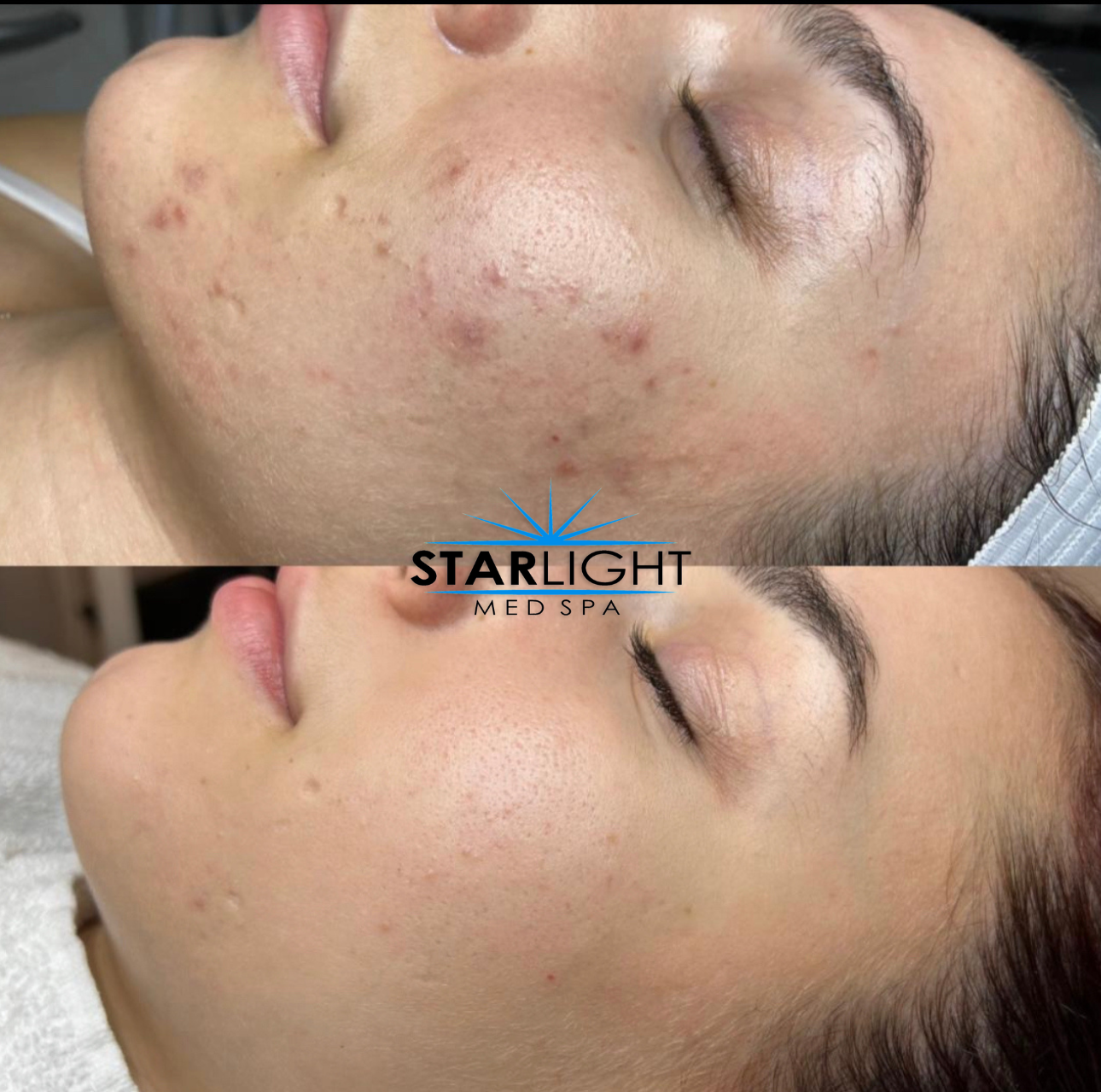 Change Your Skin this Winter with Starlight's Favourite Transformation ...