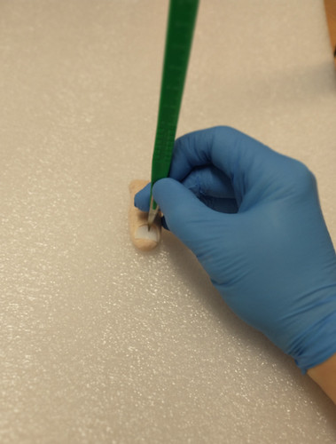 Nail Trephination Model | Fischer Simulation