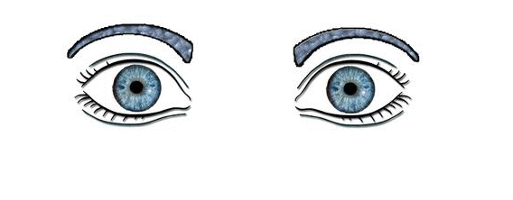 Eye strain - Queries & Remedies