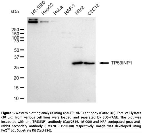 Anti-TP53INP1 Rabbit Monoclonal Ab#2816 | GenuIN Biotech