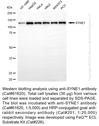 KD-Validated Anti-SYNE1 Rabbit Monoclonal Ab #61620 | GenuIN Biotech