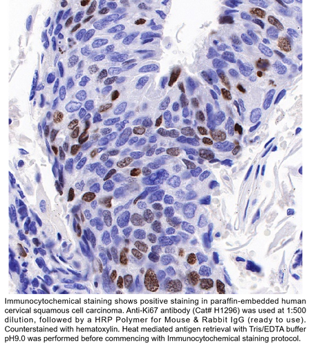 Anti-B7-H3/CD276 Rabbit Monoclonal Ab #H1297 | GenuIN Biotech