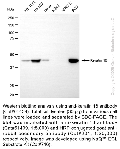 KD-Validated Anti-KeRatin 18 Rabbit mAb #61439 | GenuIN Biotech