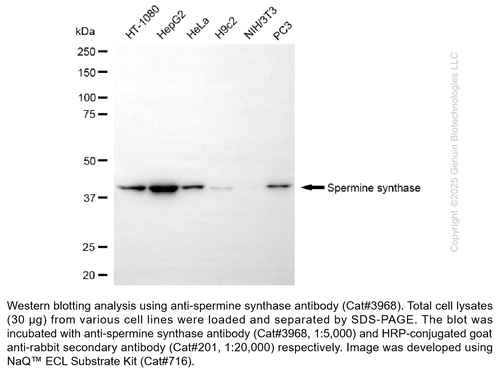 Anti-Spermine synthase Rabbit Monoclonal Ab #3968 | GenuIN Biotech