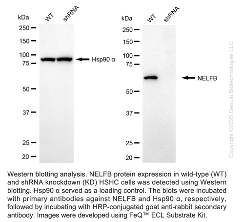 WB-Validated NELFB Knockdown Cell Lysate Kit #L61643 | GenuIN Biotech