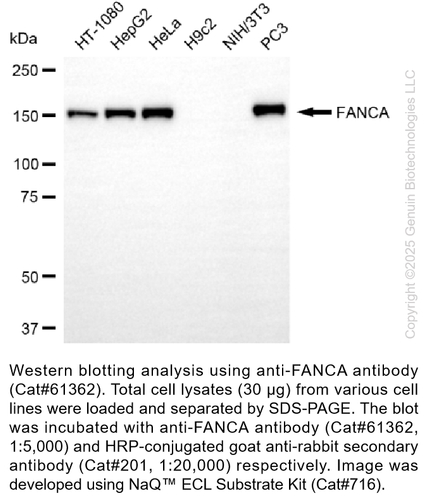 KD-Validated Anti-FANCA Rabbit mAb #61362 | GenuIN Biotech