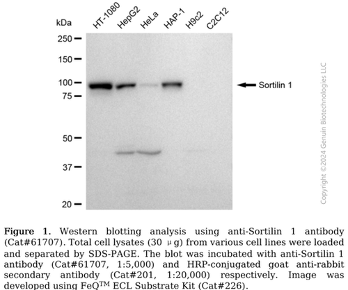 KD-Validated Anti-Sortilin 1 Rabbit Monoclonal Ab#61707 | GenuIN Biotech
